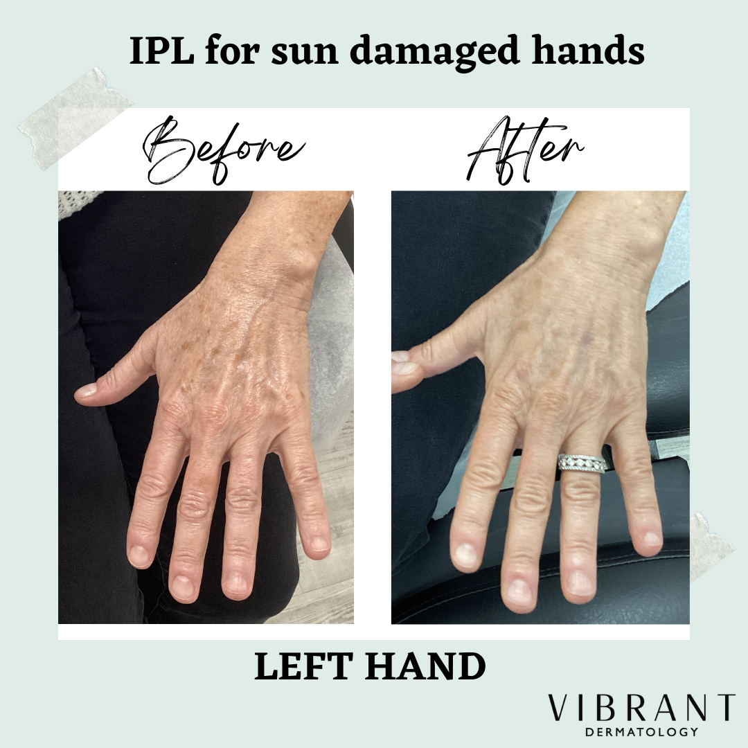 Forties Dedham - Vibrant Dermatology